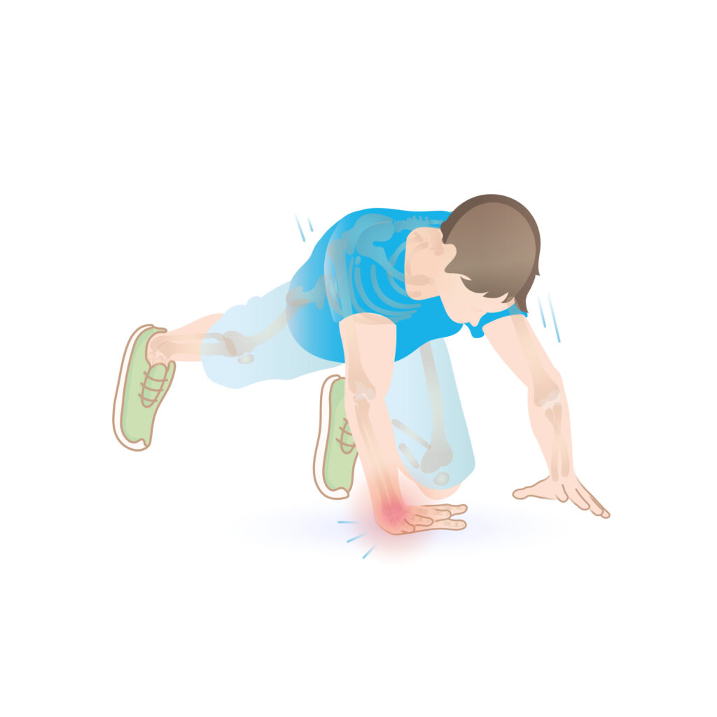 Free Human Anatomy Illustrations - Injurymap