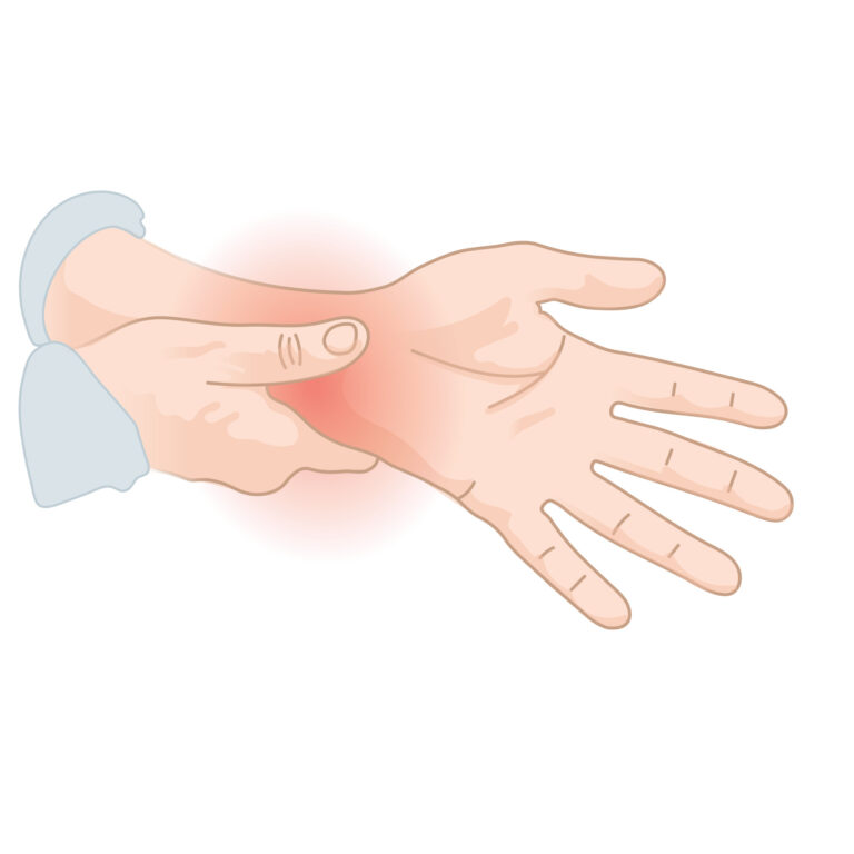 Free Human Anatomy Illustrations - Injurymap