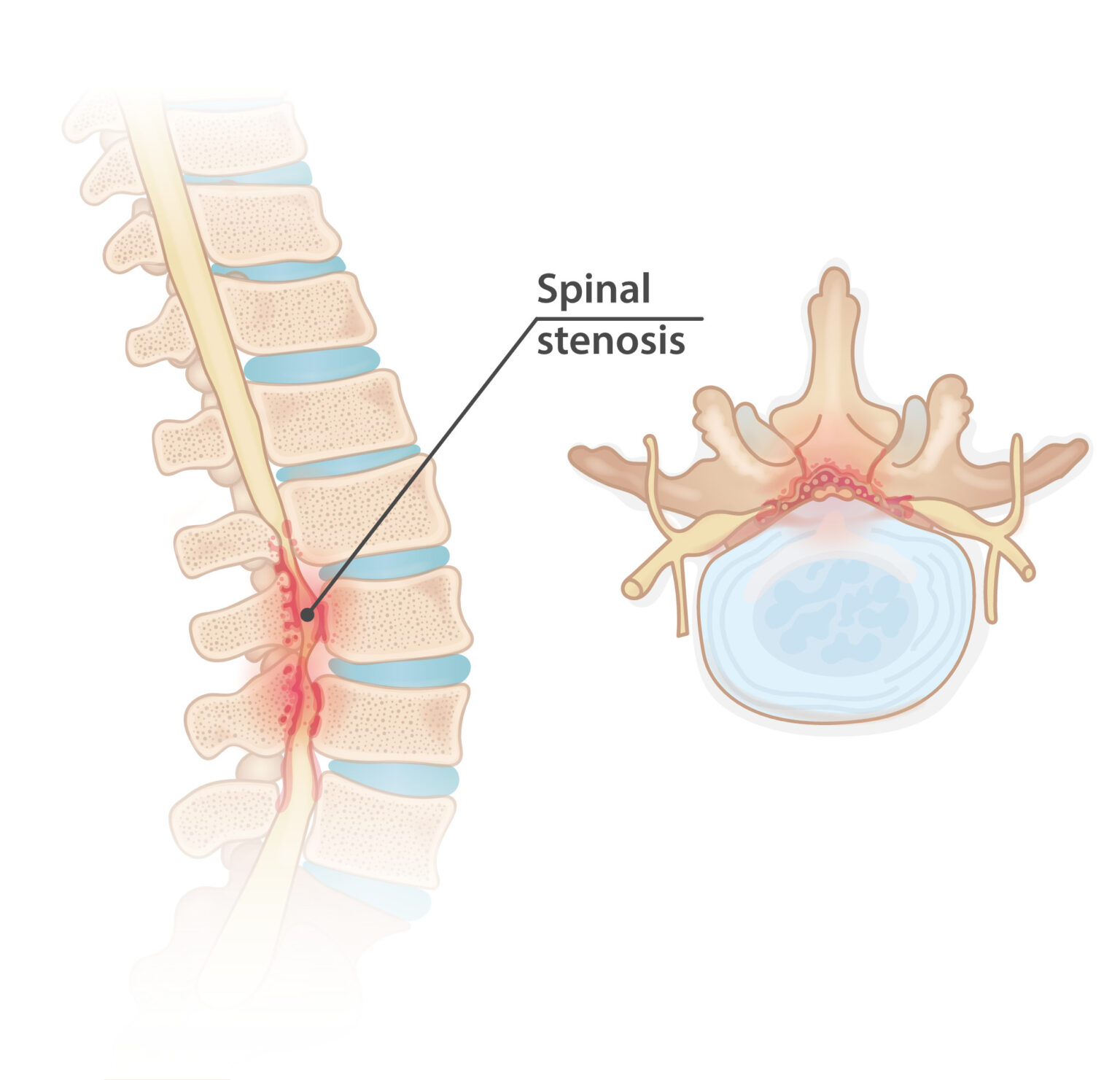 Free Human Anatomy Illustrations - Injurymap